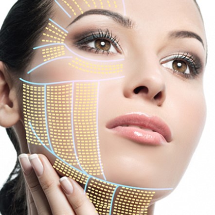 Facelift in Turkey: 3 best clinics ️ Price of circular facelift in ...
