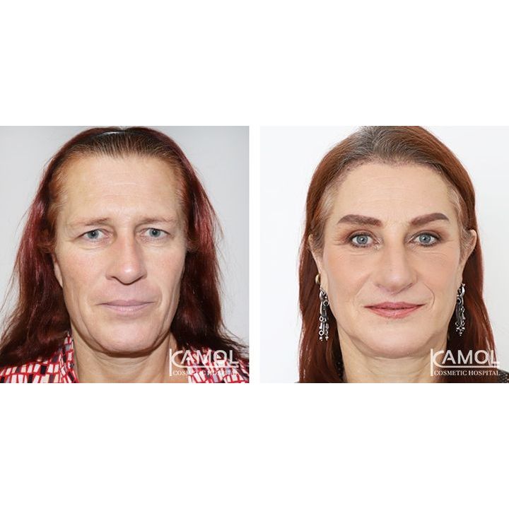 Kamol Hospital in Bangkok, Thailand ️ Prices and reviews of treatment ...