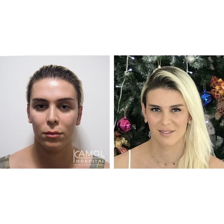 Kamol Hospital in Bangkok, Thailand ️ Prices and reviews of treatment at Kamol Hospital